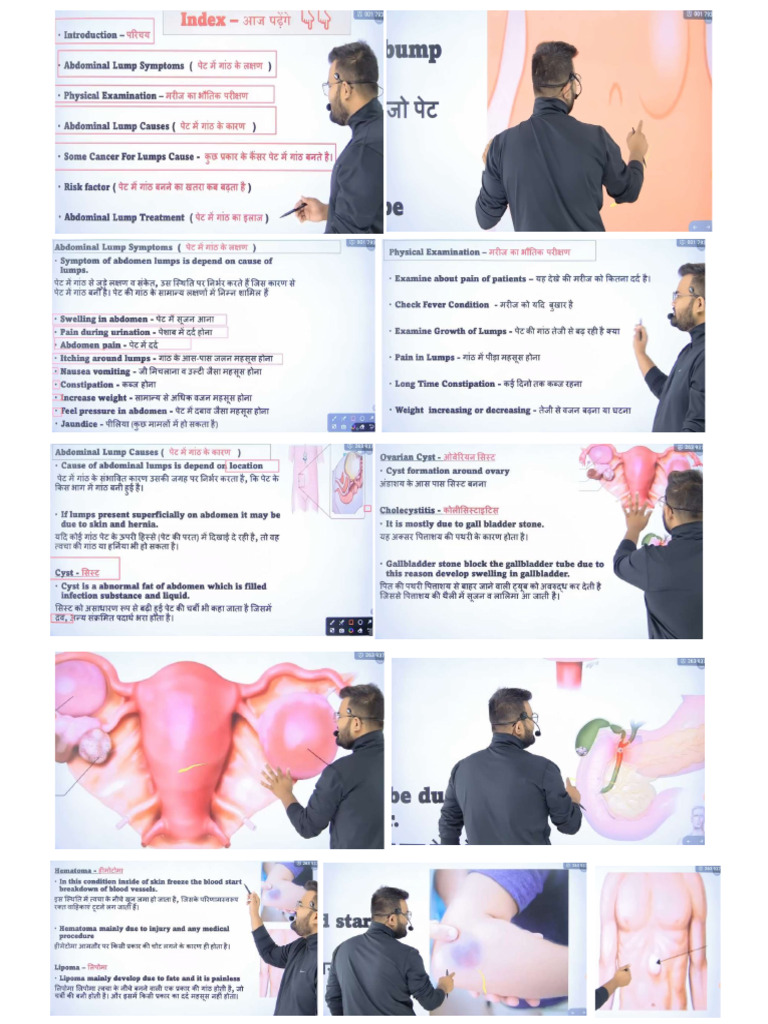 Abdomen Ganth Problems | PDF