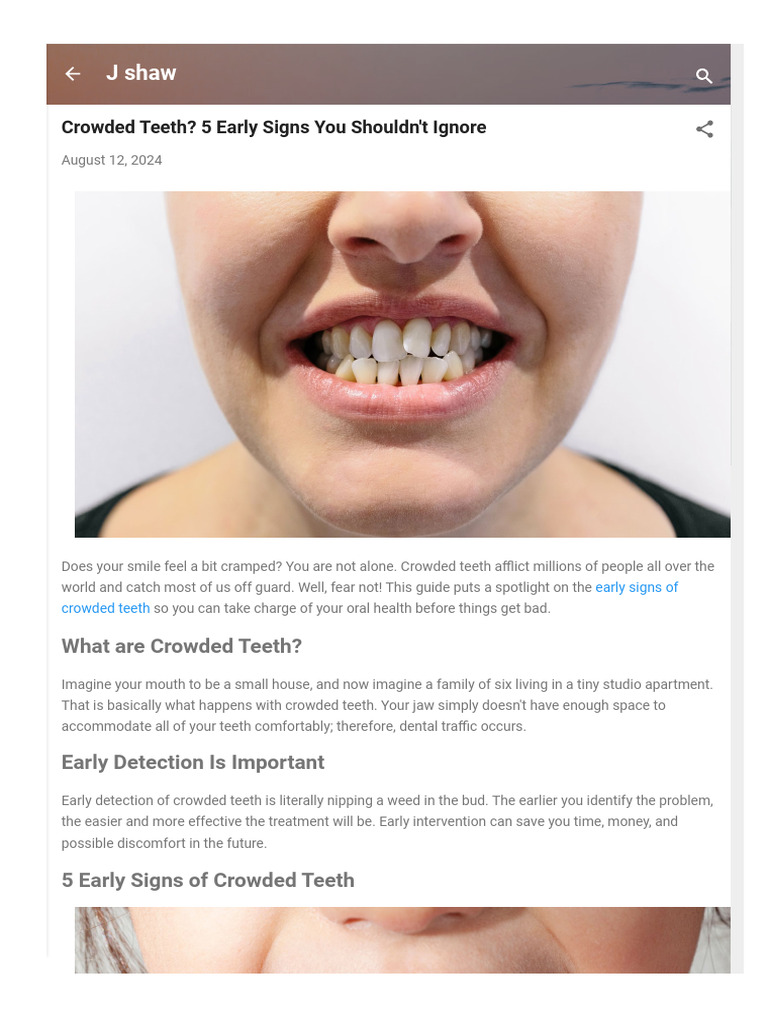 Early Signs of Crowded Teeth Explained | PDF | Human Tooth | Mouth