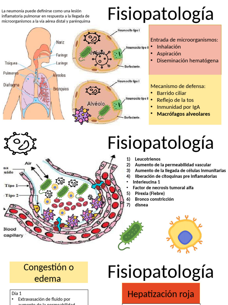 Fisiopatoligía Neumonia | PDF