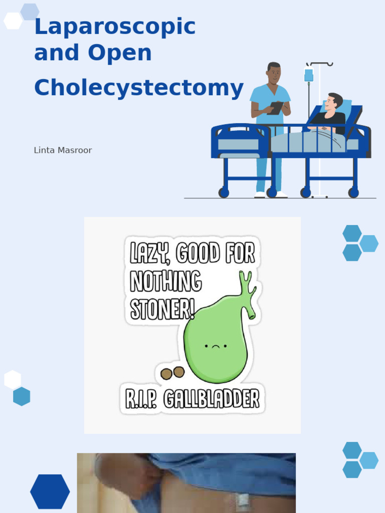 Laparoscopic Cholecystectomy | PDF