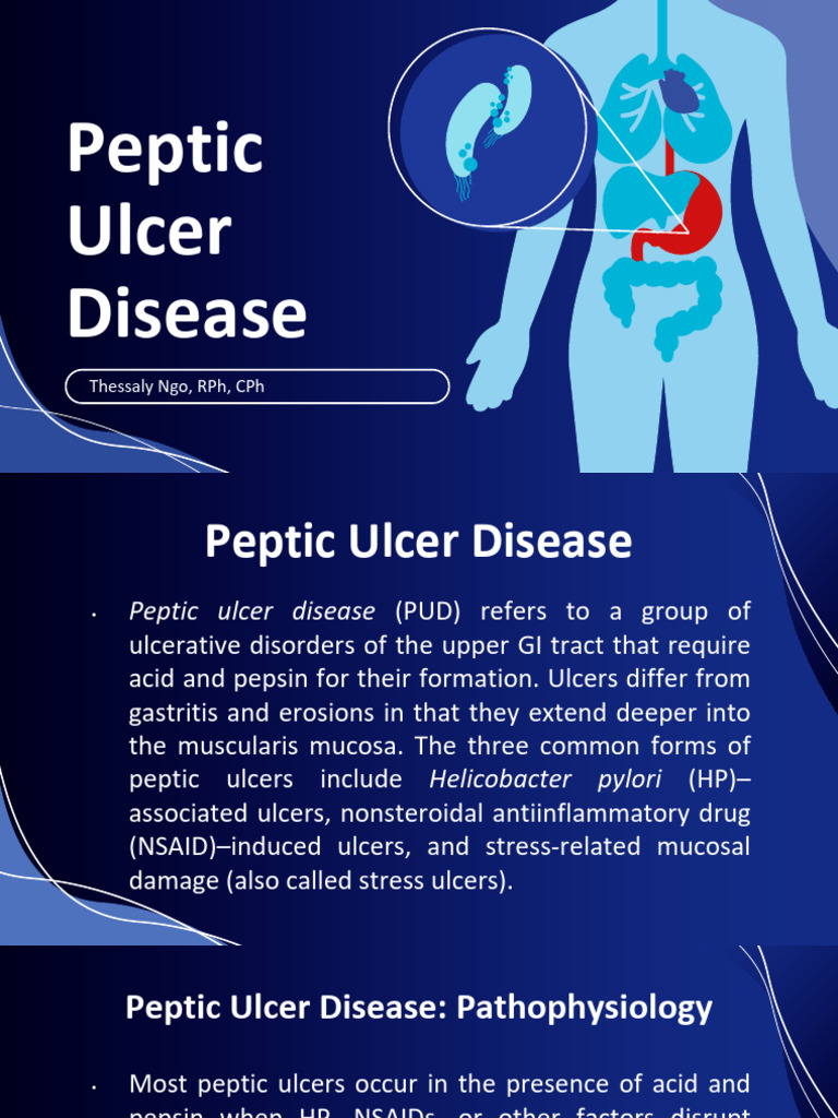 Peptic Ulcer | PDF