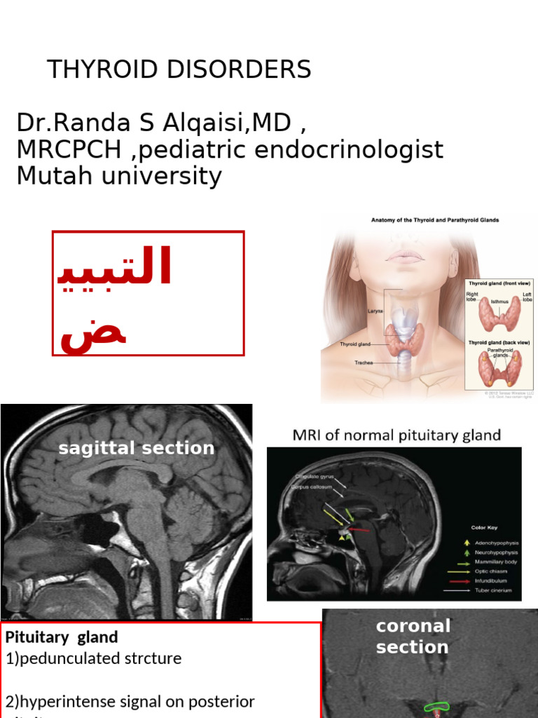 Understanding Thyroid Disorders in Pediatrics | PDF | Hyperthyroidism ...