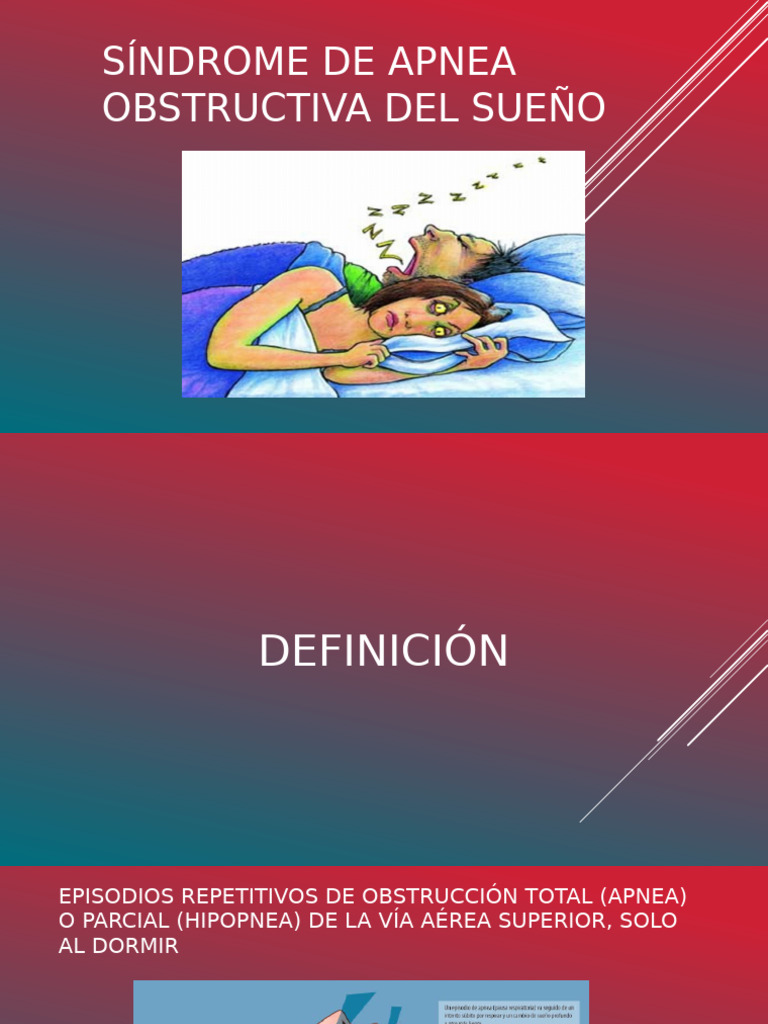 Síndrome de Apneas Obstructiva Del Sueño | PDF | Apnea del sueño