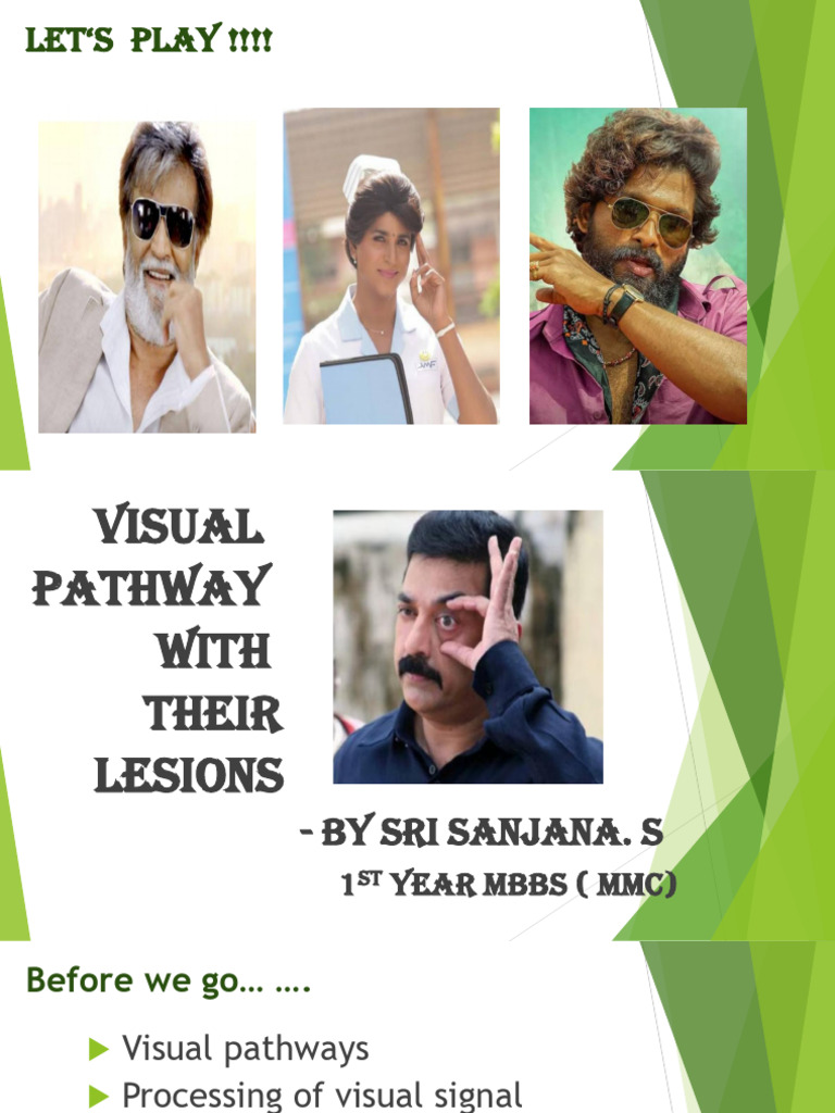 Visual Pathway - Sanjana | PDF