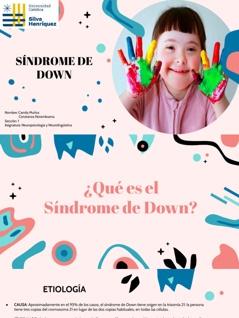 Sindrome de Down | PDF