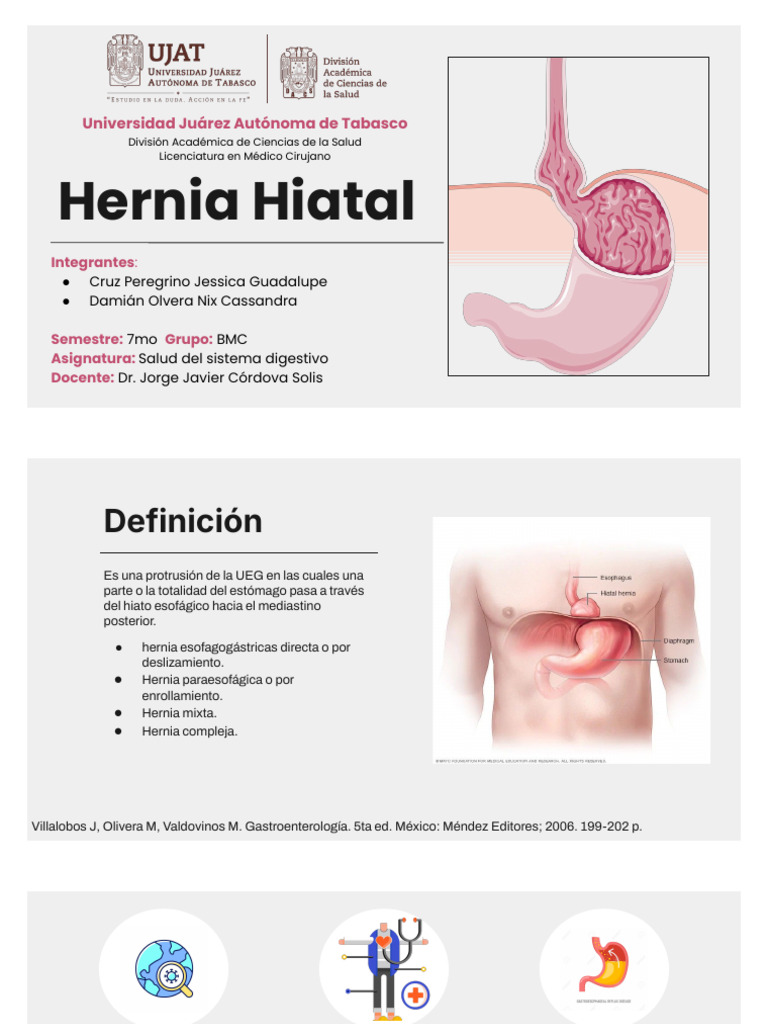 Hernia Hiatal | PDF | Gastroenterology | Digestive Diseases