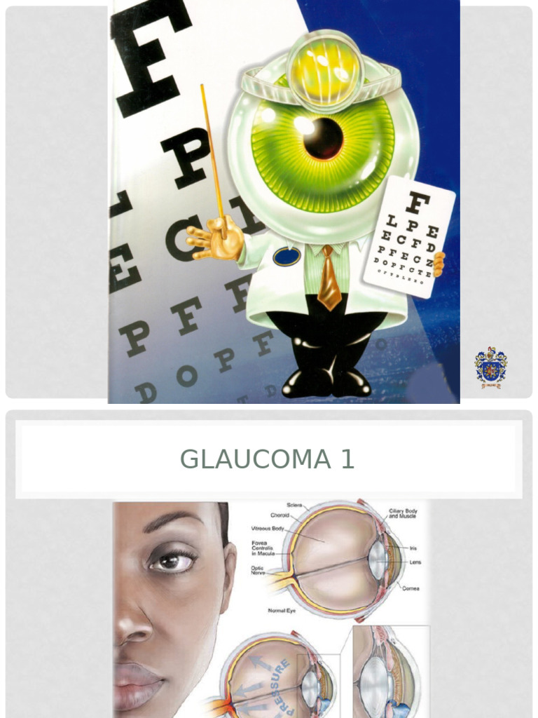 Glaucoma | PDF