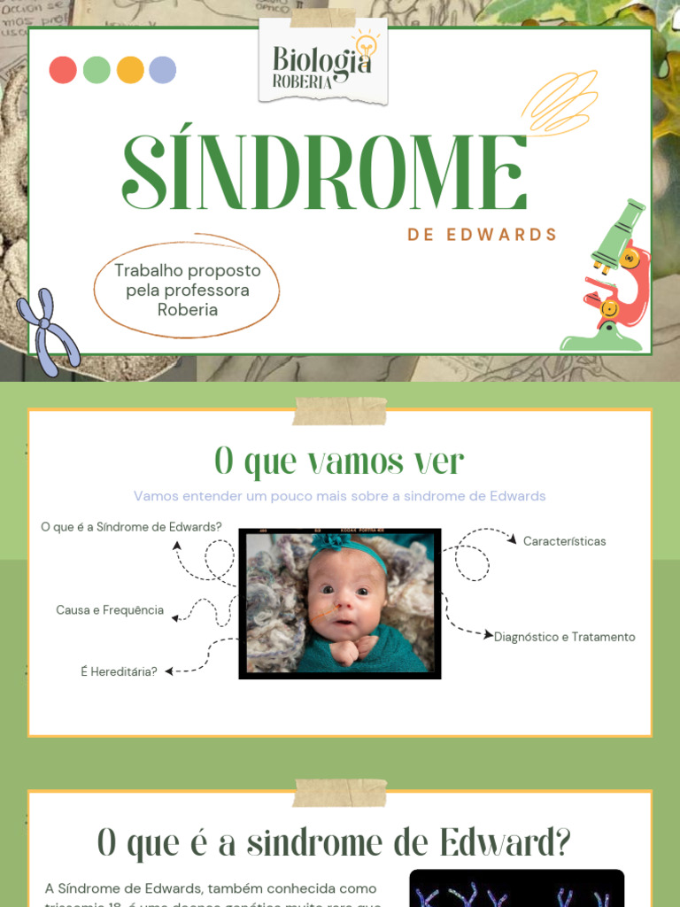 Síndrome de Edwards | PDF | Enfermedades y trastornos | Medicina