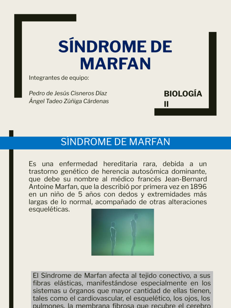 Síndrome de Marfan | PDF