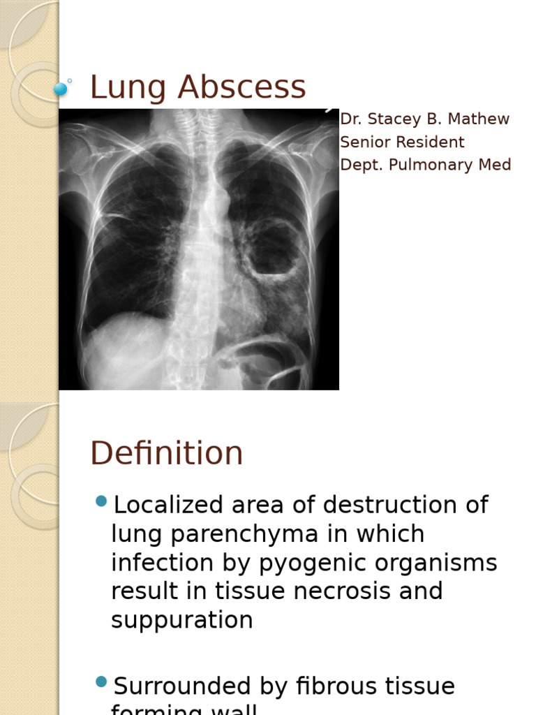 Lung Abscess | PDF