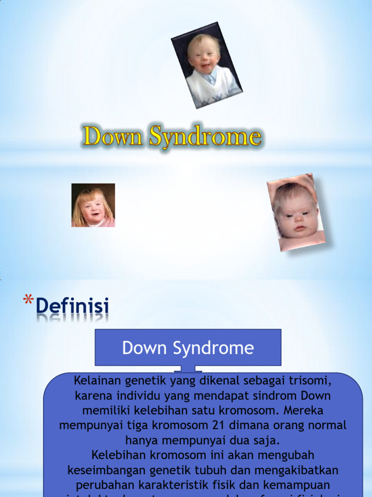 Sindrom Down | PDF