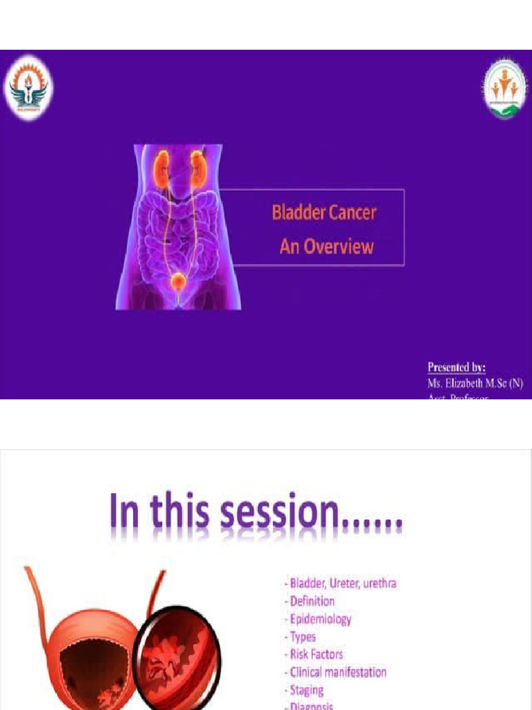 Bladder Cancer | PDF