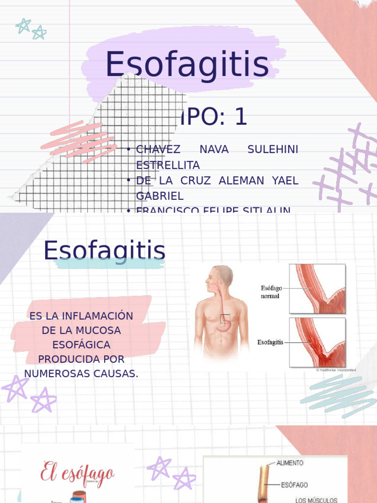 ESOFAGITIS | PDF