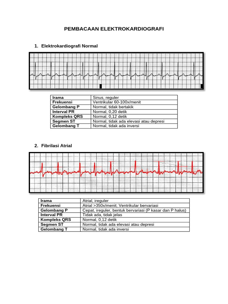 11 Pembacaan EKG | PDF