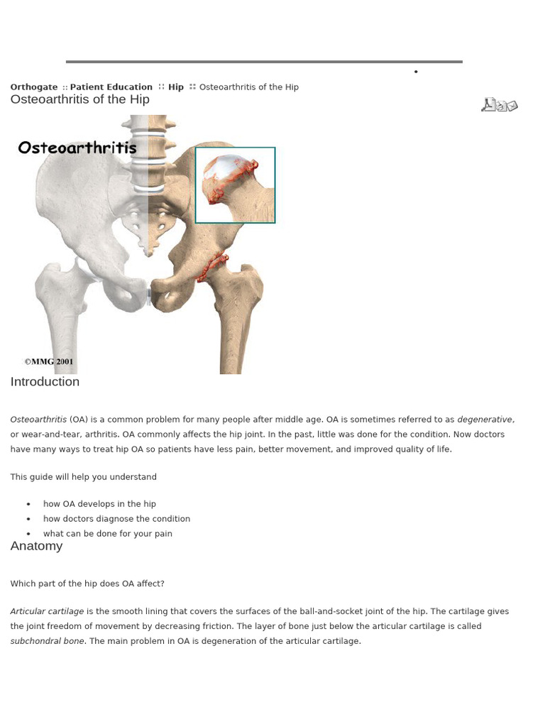 Osteoarthritis of The Hip: Orthogate Patient Education Hip | PDF