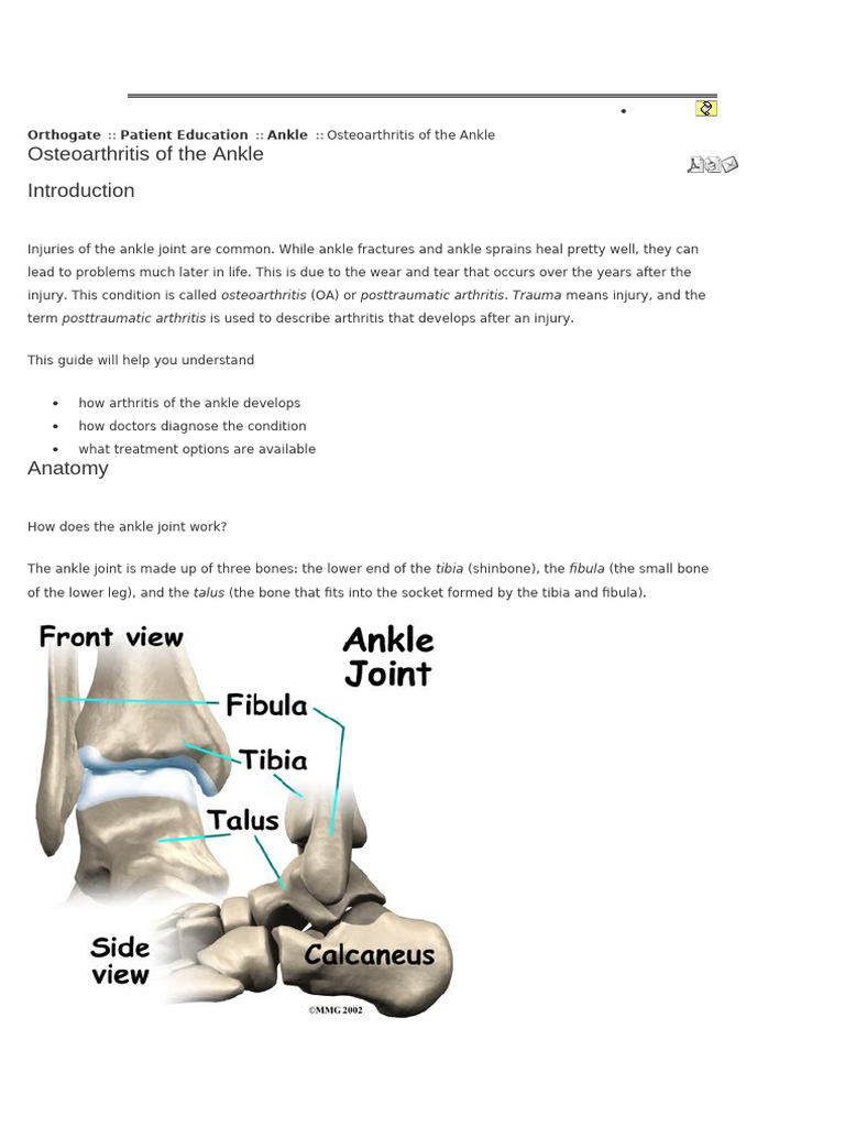Osteoarthritis of The Ankle: Orthogate Patient Education Ankle | PDF