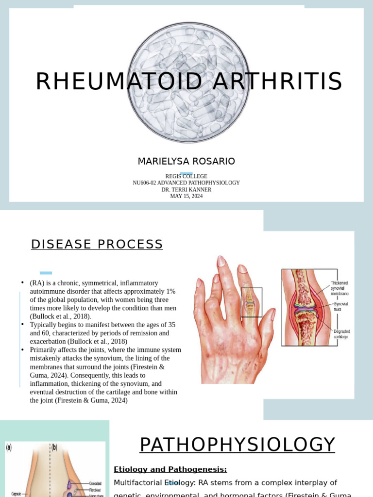 Rheumatoid Arthritis | PDF