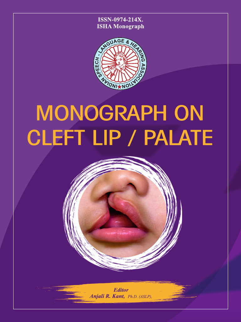 Cleft Lip and Palate | PDF