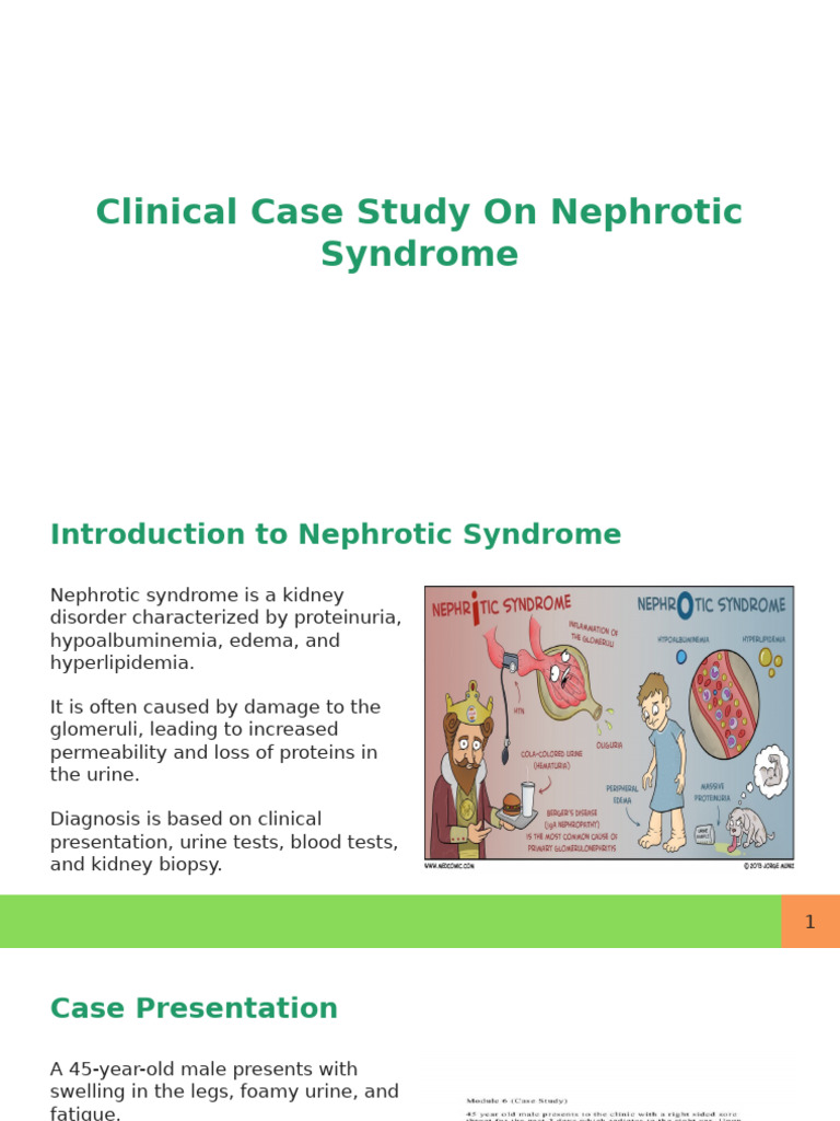 Clinical Case Study On Nephrotic Syndrome | PDF
