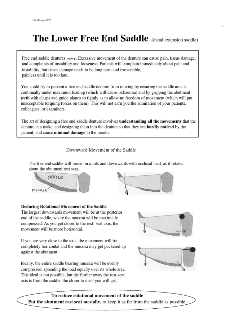 Free End Saddle | Dentures | Dentistry