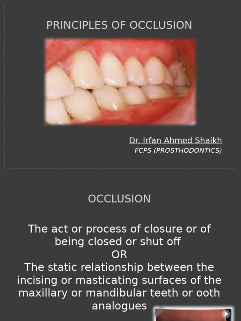 PRINCIPLES OF OCCLUSION Final | PDF
