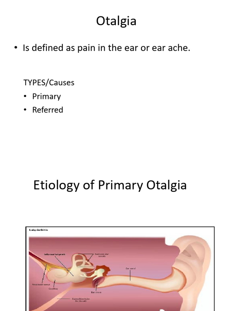 Otalgia | PDF