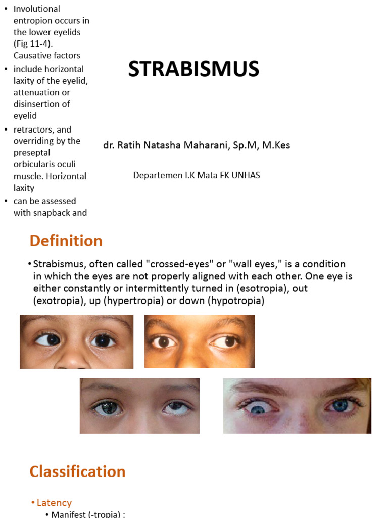 Strabismus | PDF