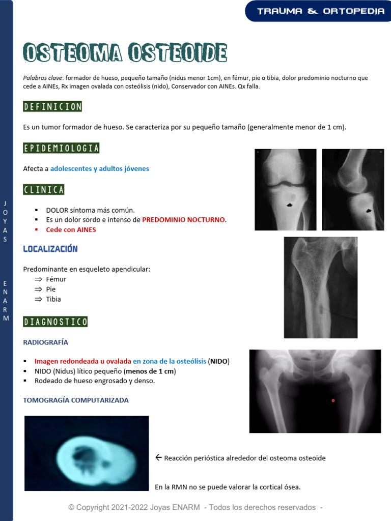 Osteoma Osteoide | PDF