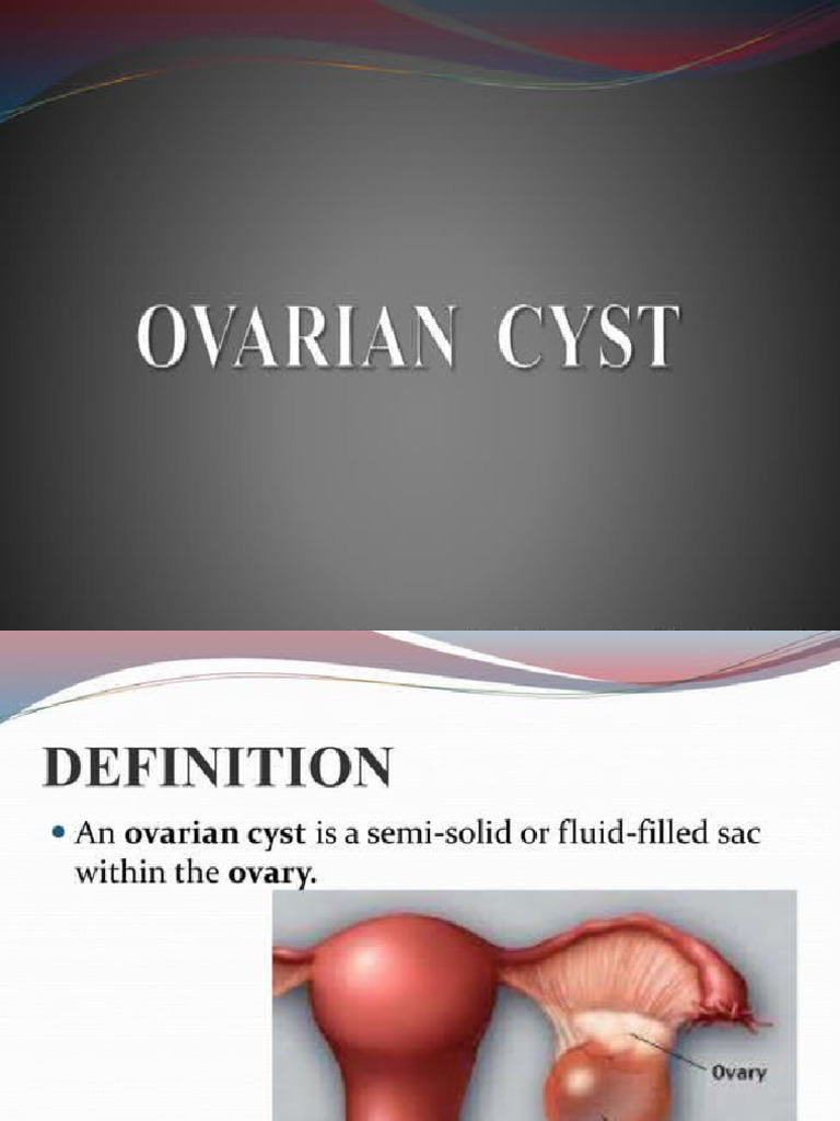 Ovarian Disorder | PDF