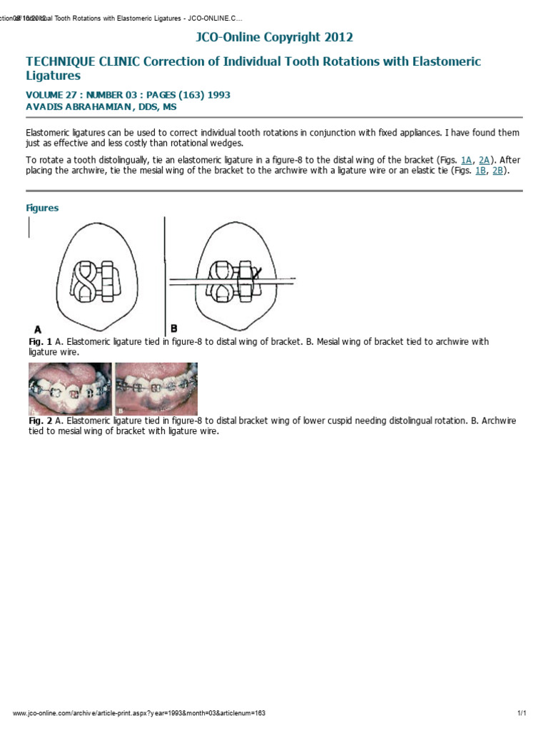 TECHNIQUE CLINIC Correction of Individual Tooth Rotations With ...