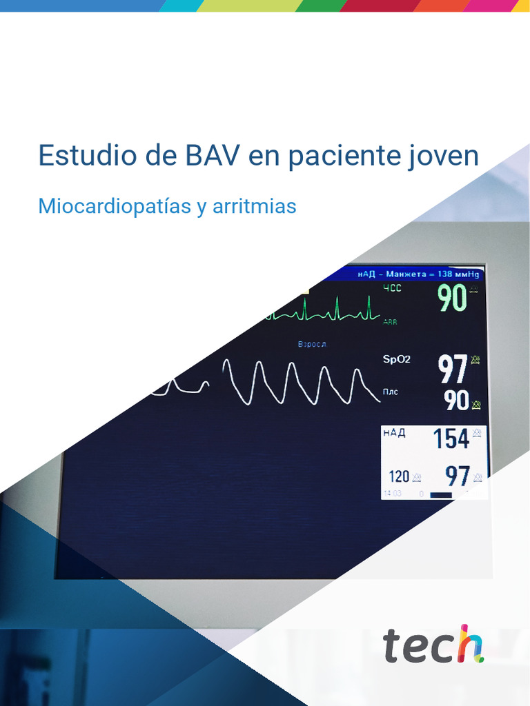 Estudio de BAV en Paciente Joven M9 T9 | PDF