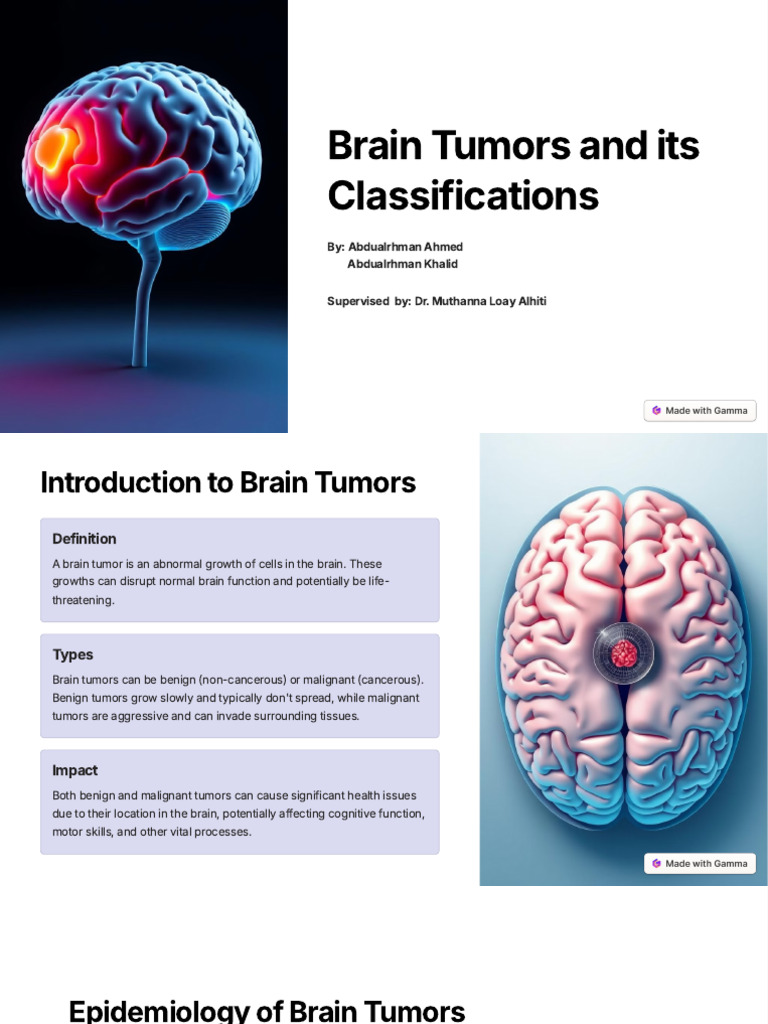 Brain Tumors and Its Classifications | PDF