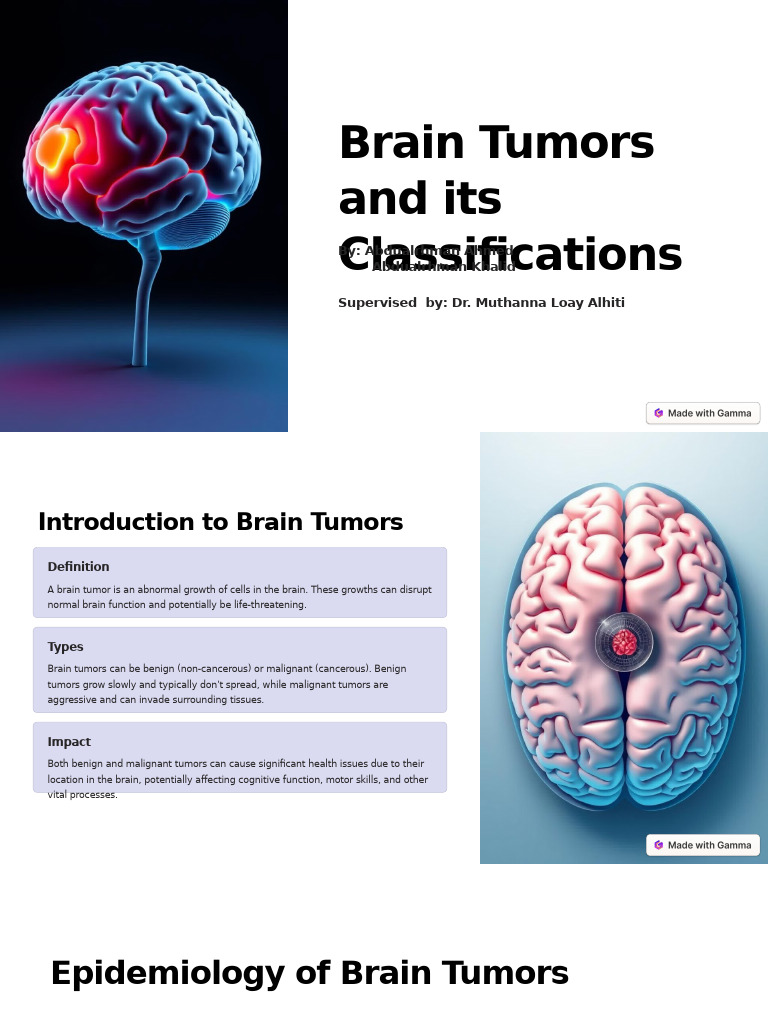 Brain Tumors and Its Classifications | PDF