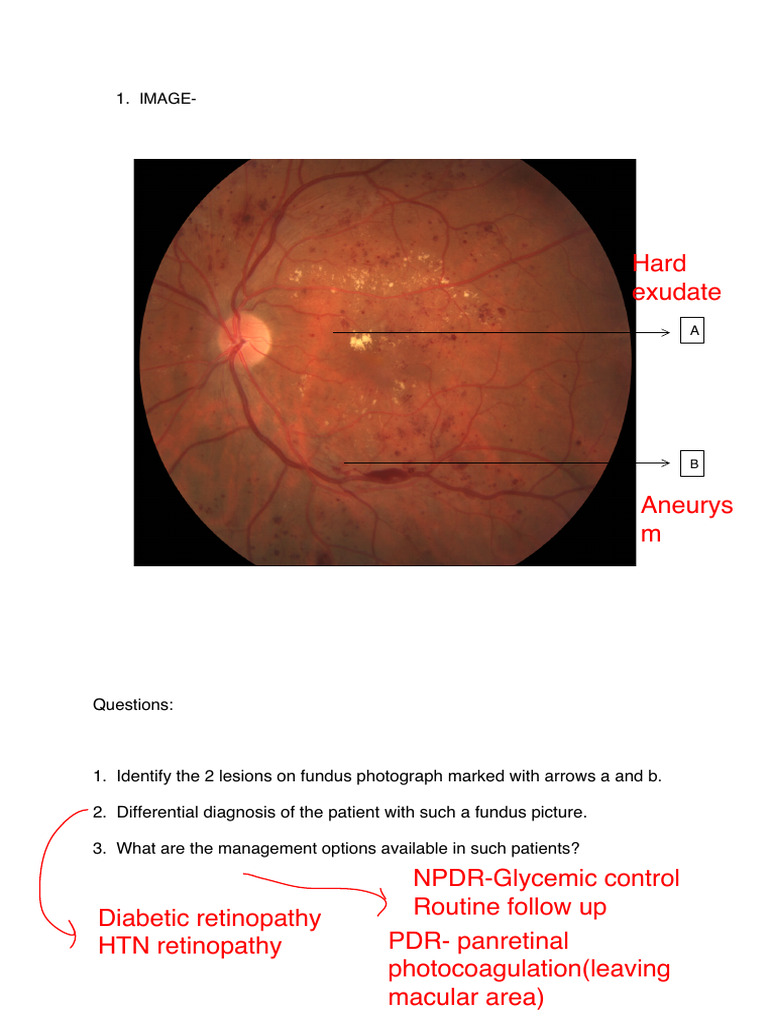 Ophthalmology OSCE - 1 | PDF