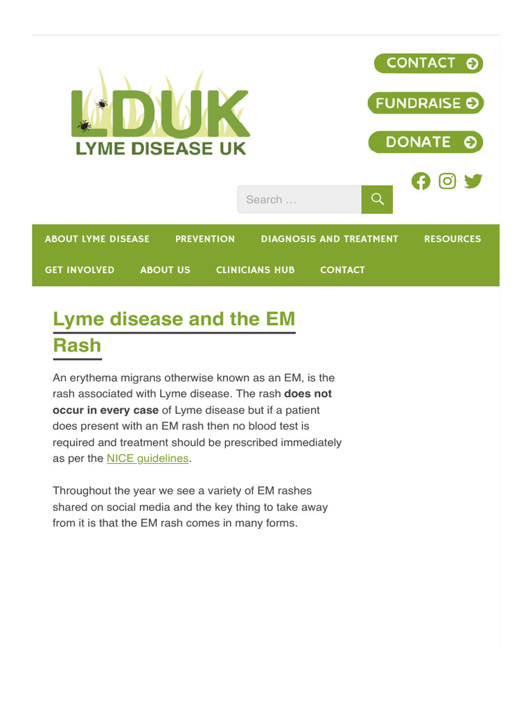 Lyme Disease UK - Lyme Disease and The EM Rash | PDF | Lyme Disease ...
