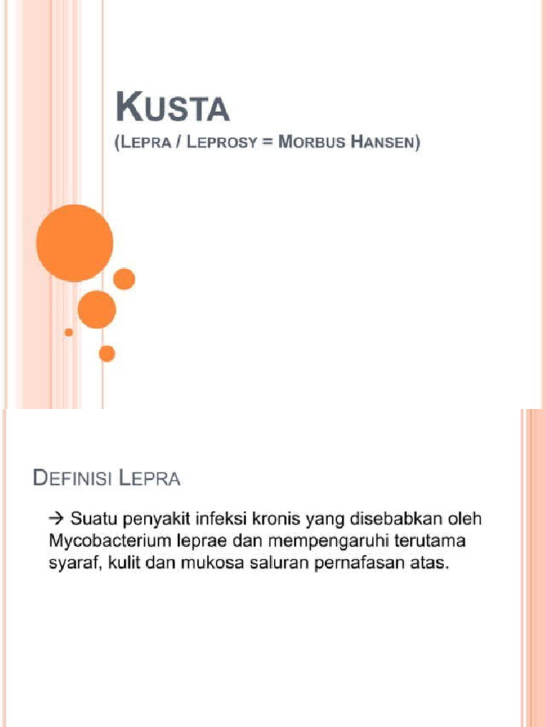 KUSTA | PDF