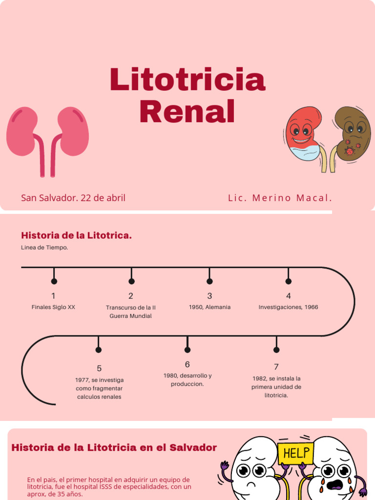 Litotricia | PDF