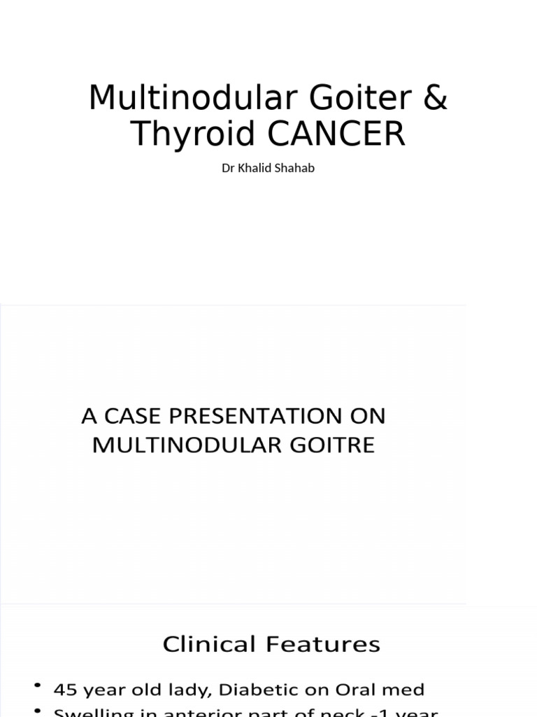 Multinodular Goiter & Thyroid CANCER | PDF