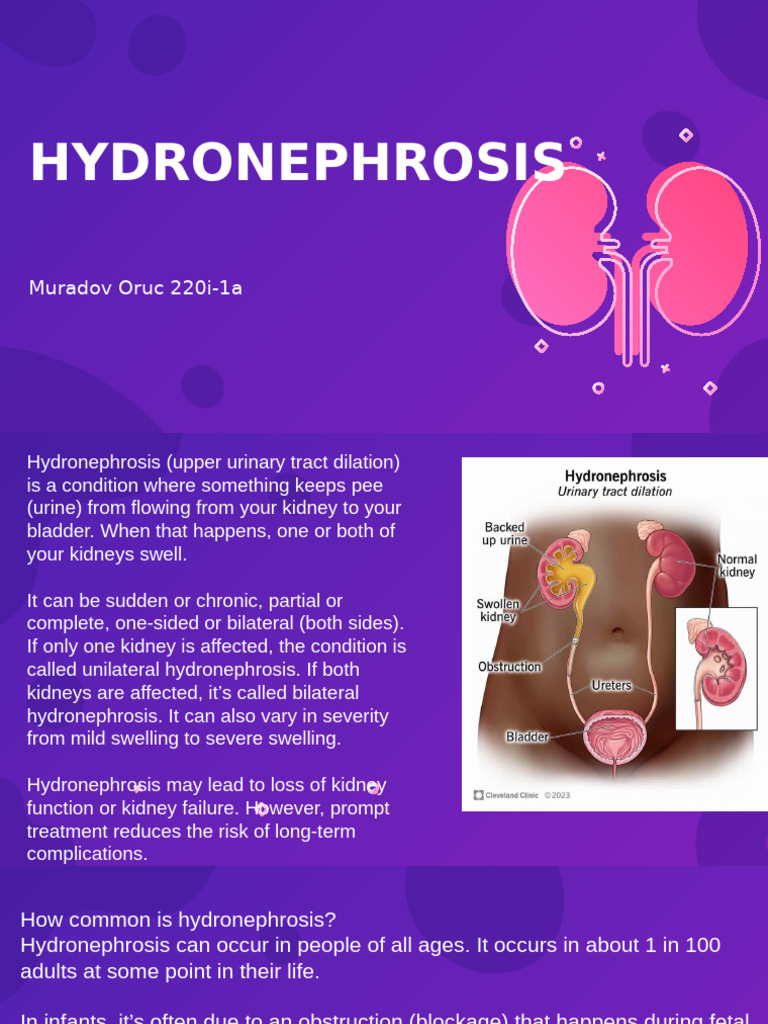 Hydronephrosis | PDF
