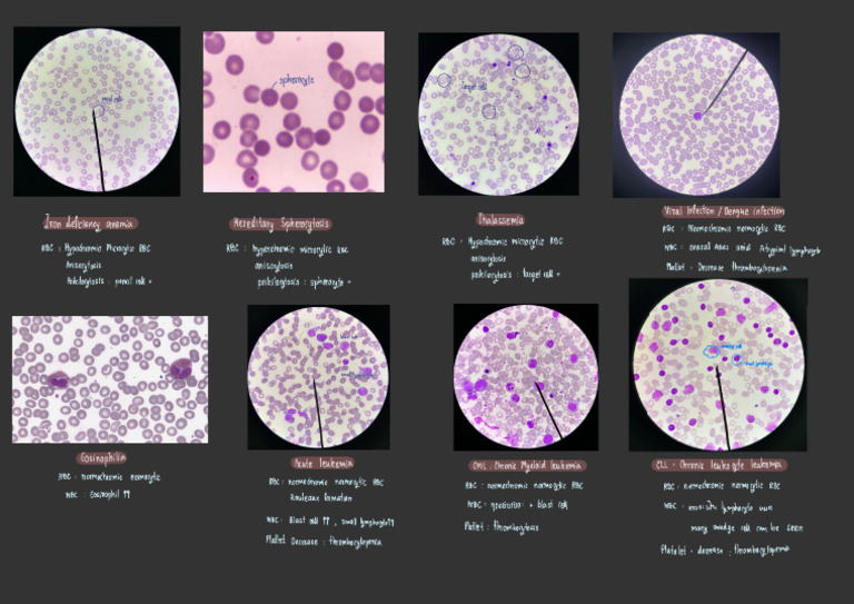 Hematology by Pare | PDF
