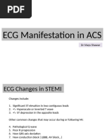 J-Point and STEMI Criteria Explained | PDF | Electrocardiography ...