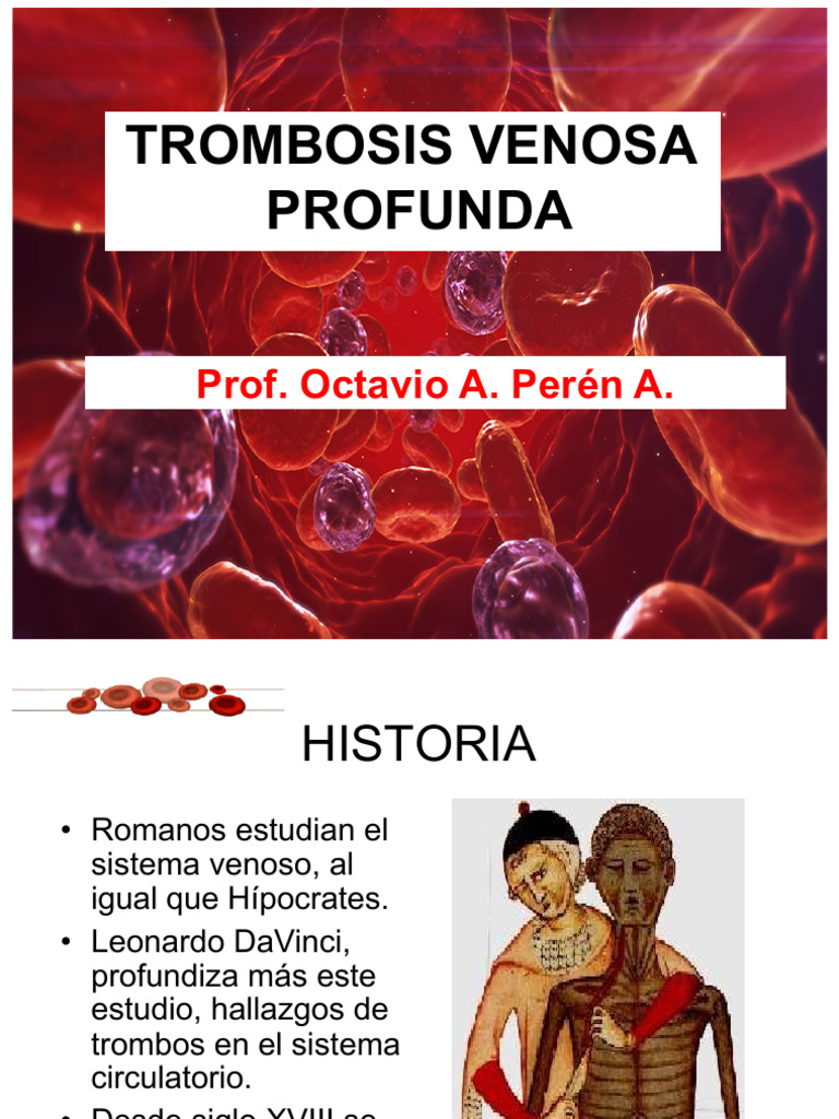 Trombosis Venosa Profunda PDF | PDF