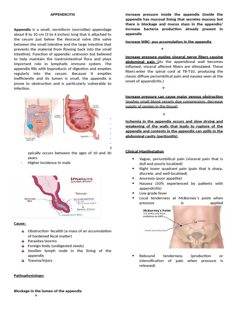 APPENDICITIS | PDF