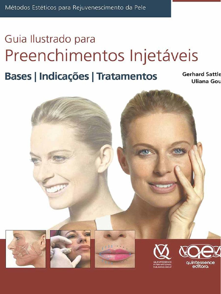 Guia ilustrada para rellenos inyectables | PDF