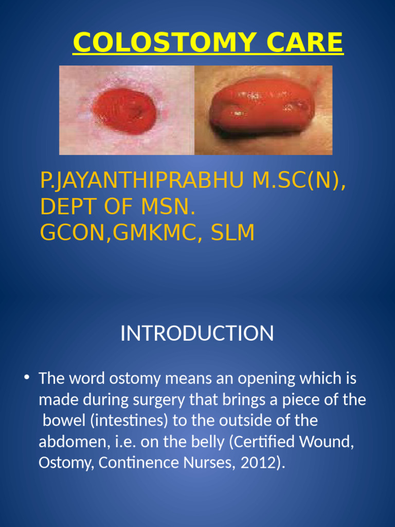 Colostomy NSG Mgment | PDF | Medical Specialties | Wellness