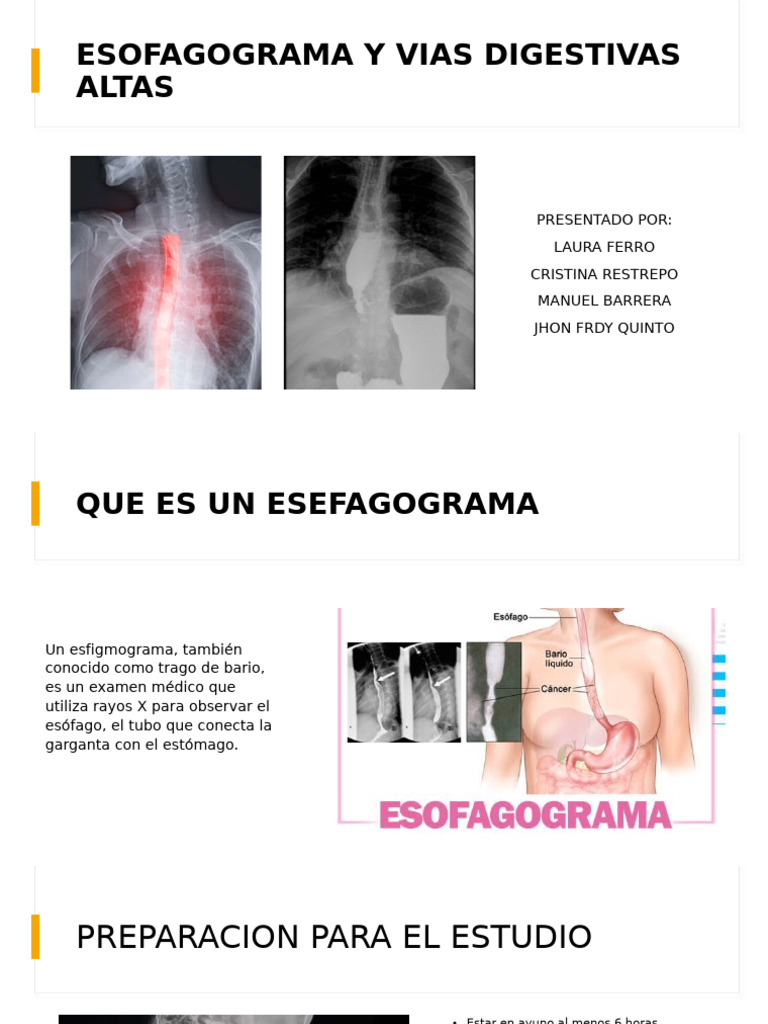 ESOFAGOGRAMA Y VIAS DIGESTIVAS ALTAS Jhon F | PDF | La enfermedad por ...