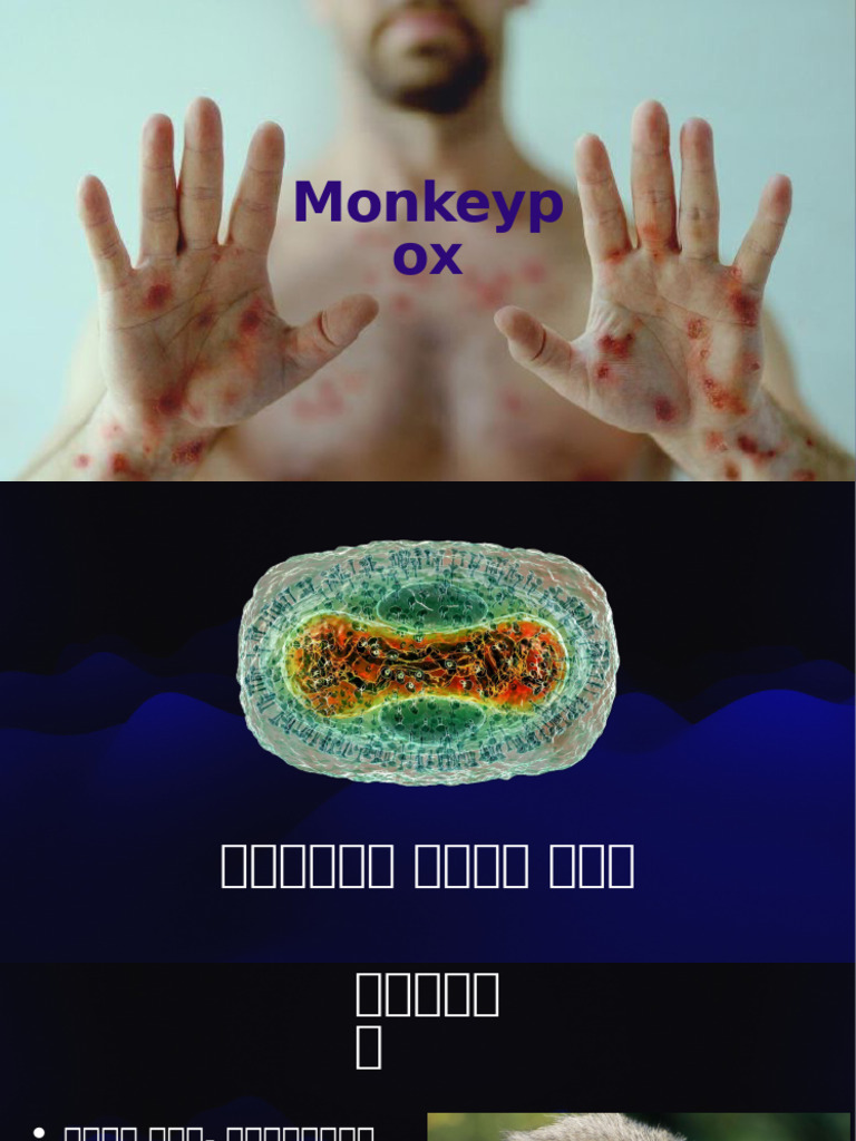 Monkeypox | PDF