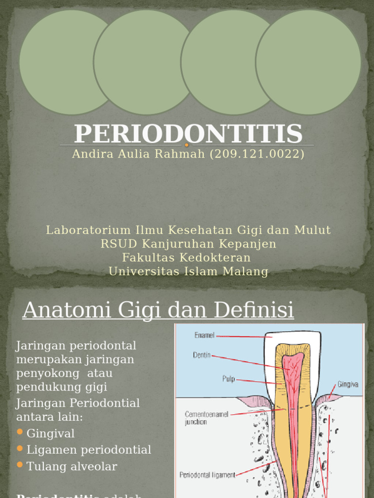 PERIODONTITIS | PDF