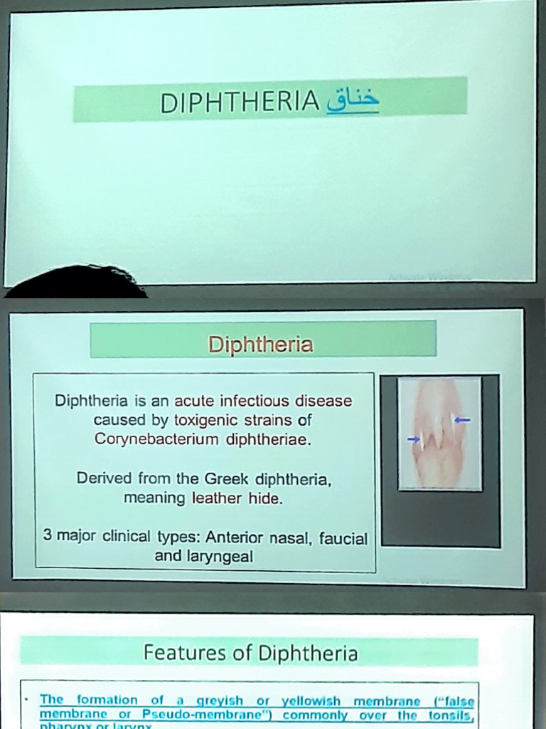 Diphtheria | PDF