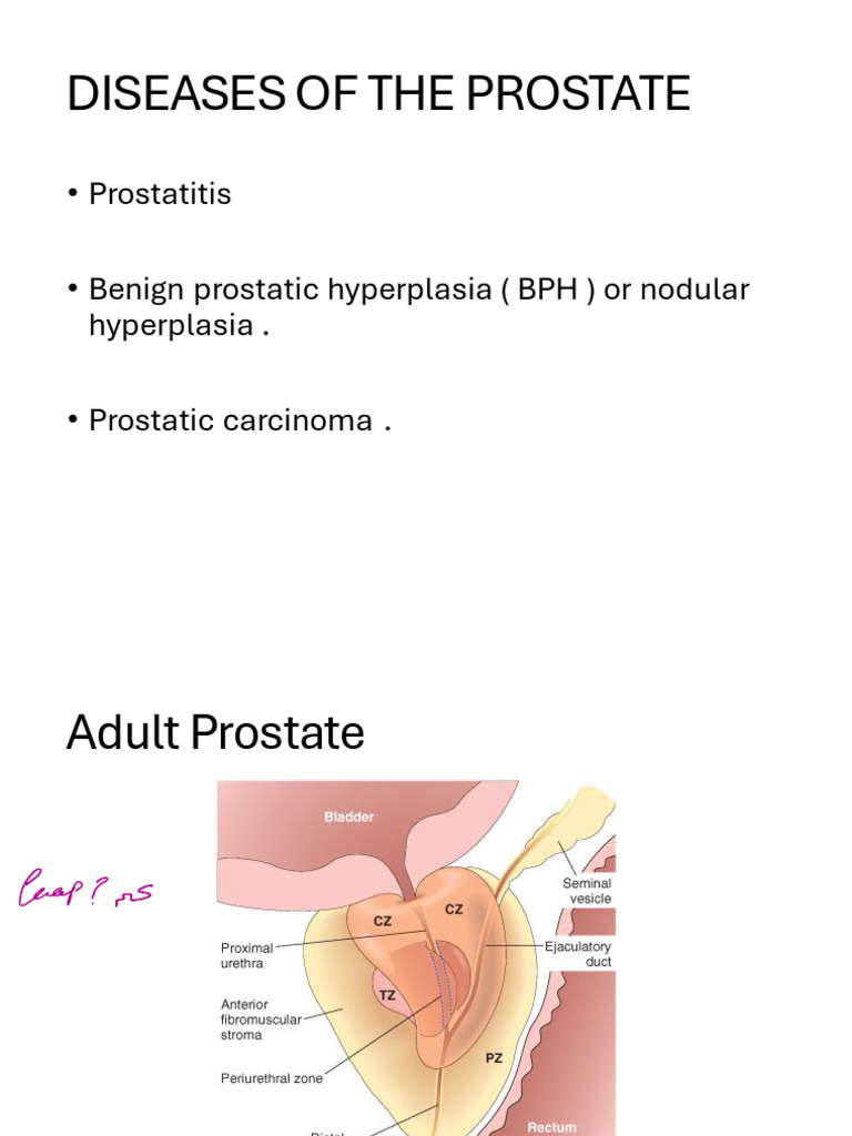 Diseases of Prostate | PDF